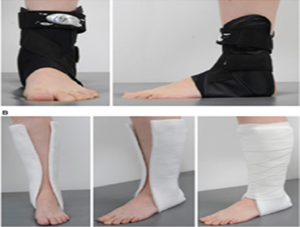Anterior Talo-Fibular Ligament (ATFL) - 7Scope Ortho Care